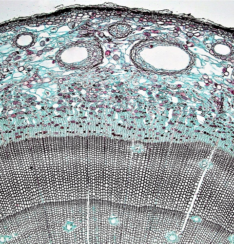 AI-Powered Digital Microscopy Solutions by ZEISS l Endava